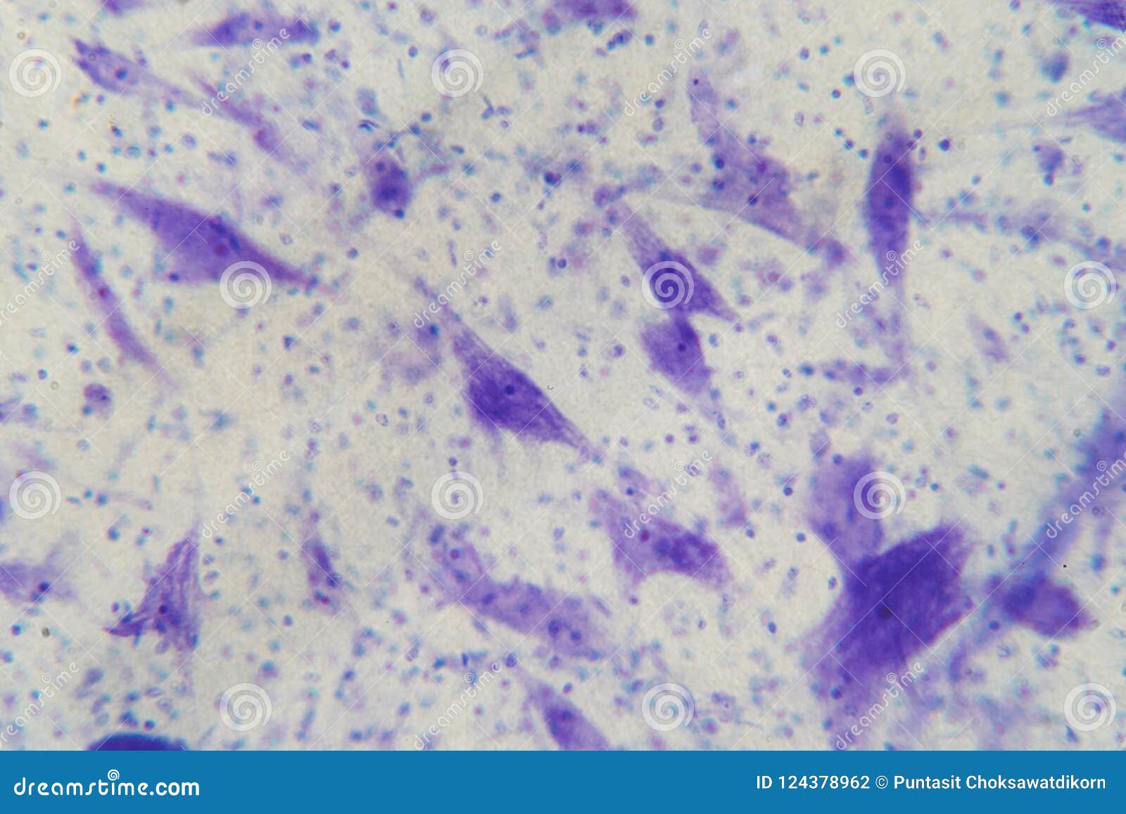 Neurons Cells from the Brain Under the Microscope View Stock Photo ...