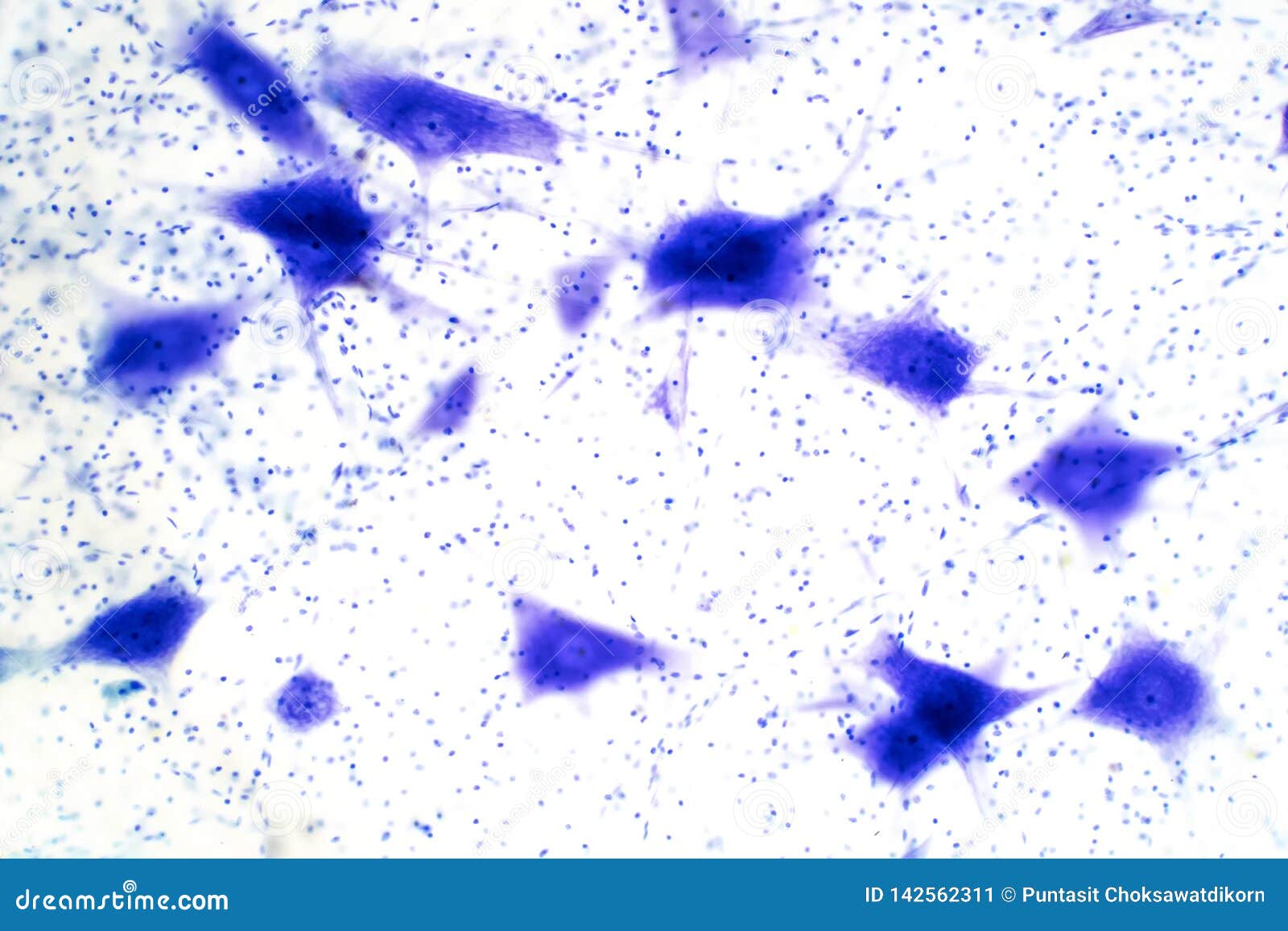 Neurons Cells from the Brain Under the Microscope View Stock Image ...