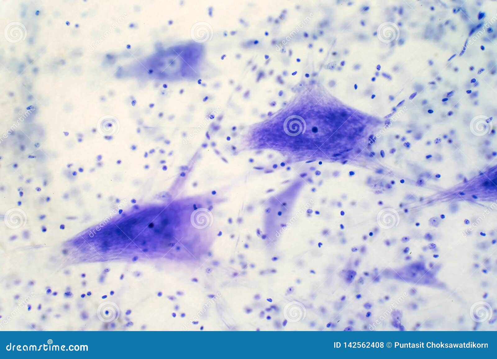 Neurons Cells from the Brain Under the Microscope View Stock Photo ...