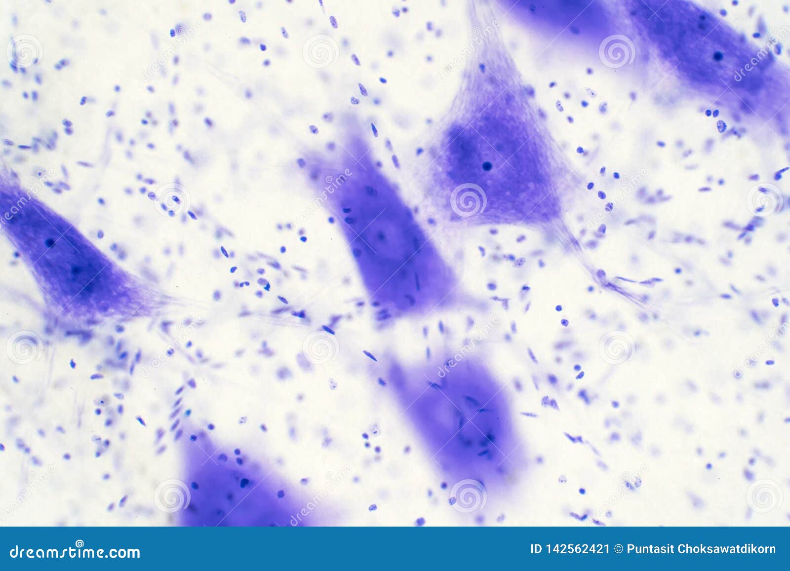 Neurons Cells from the Brain Under the Microscope View Stock Image ...