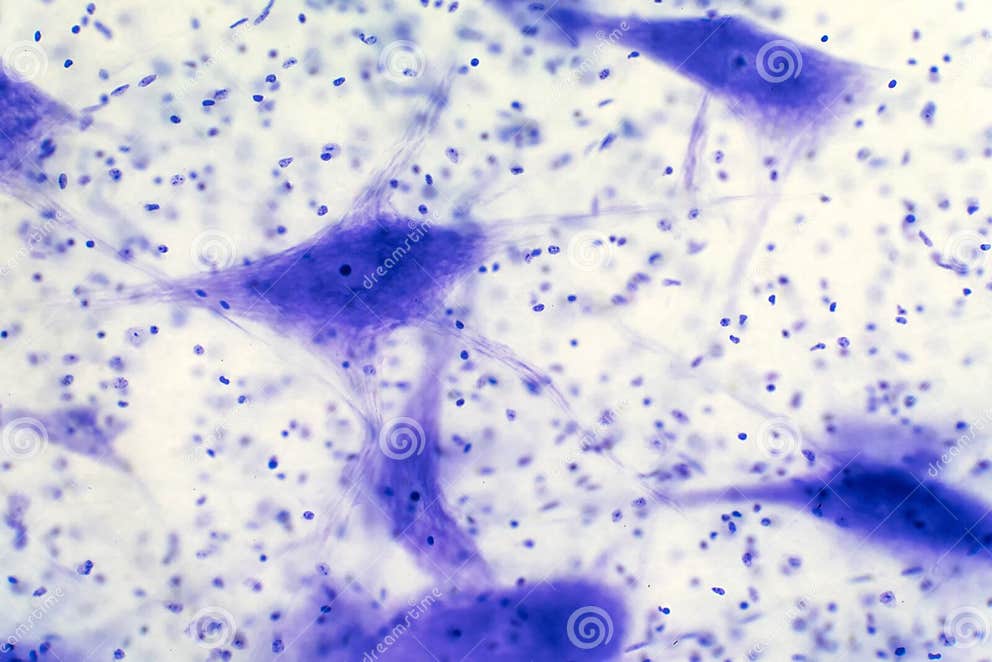 Neurons Cells from the Brain Under the Microscope View Stock Photo ...