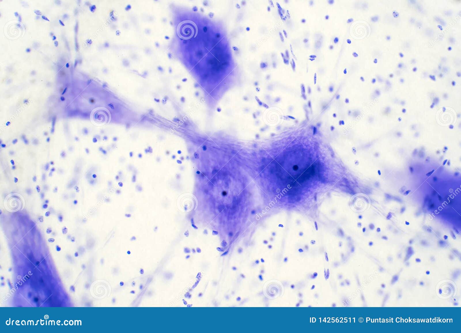 Neurons Cells from the Brain Under the Microscope View Stock Image ... Neurons Cells from the Brain Under the Microscope View Stock Image ...