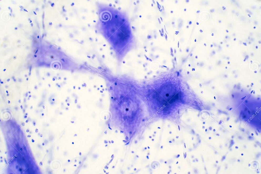 Neurons Cells from the Brain Under the Microscope View Stock Image ...