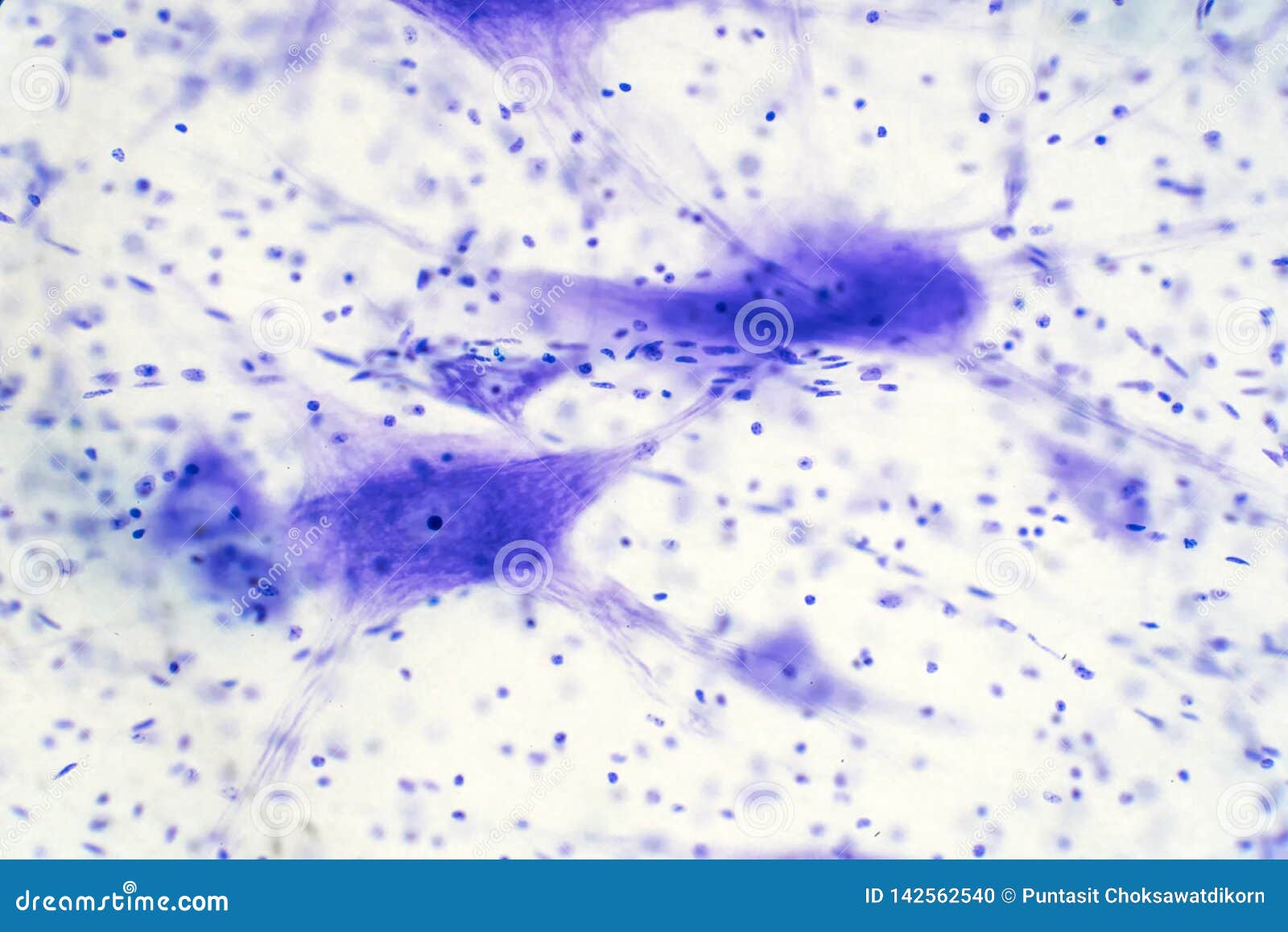 Neurons Cells from the Brain Under the Microscope View Stock Photo ...