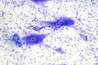Neurons Cells from the Brain Under the Microscope View Stock Photo ...