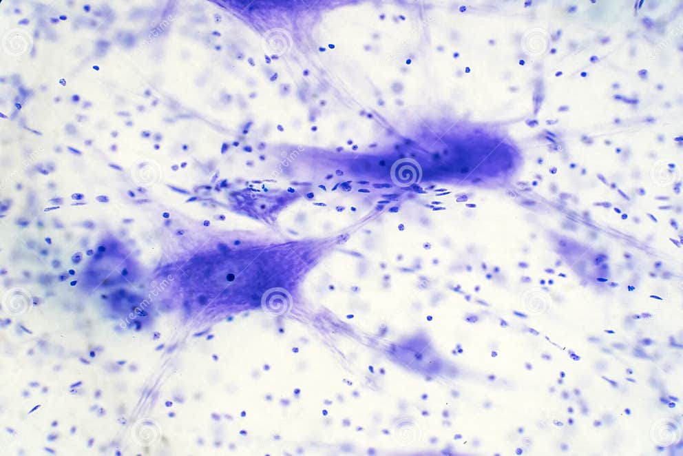 Neurons Cells from the Brain Under the Microscope View Stock Photo ...