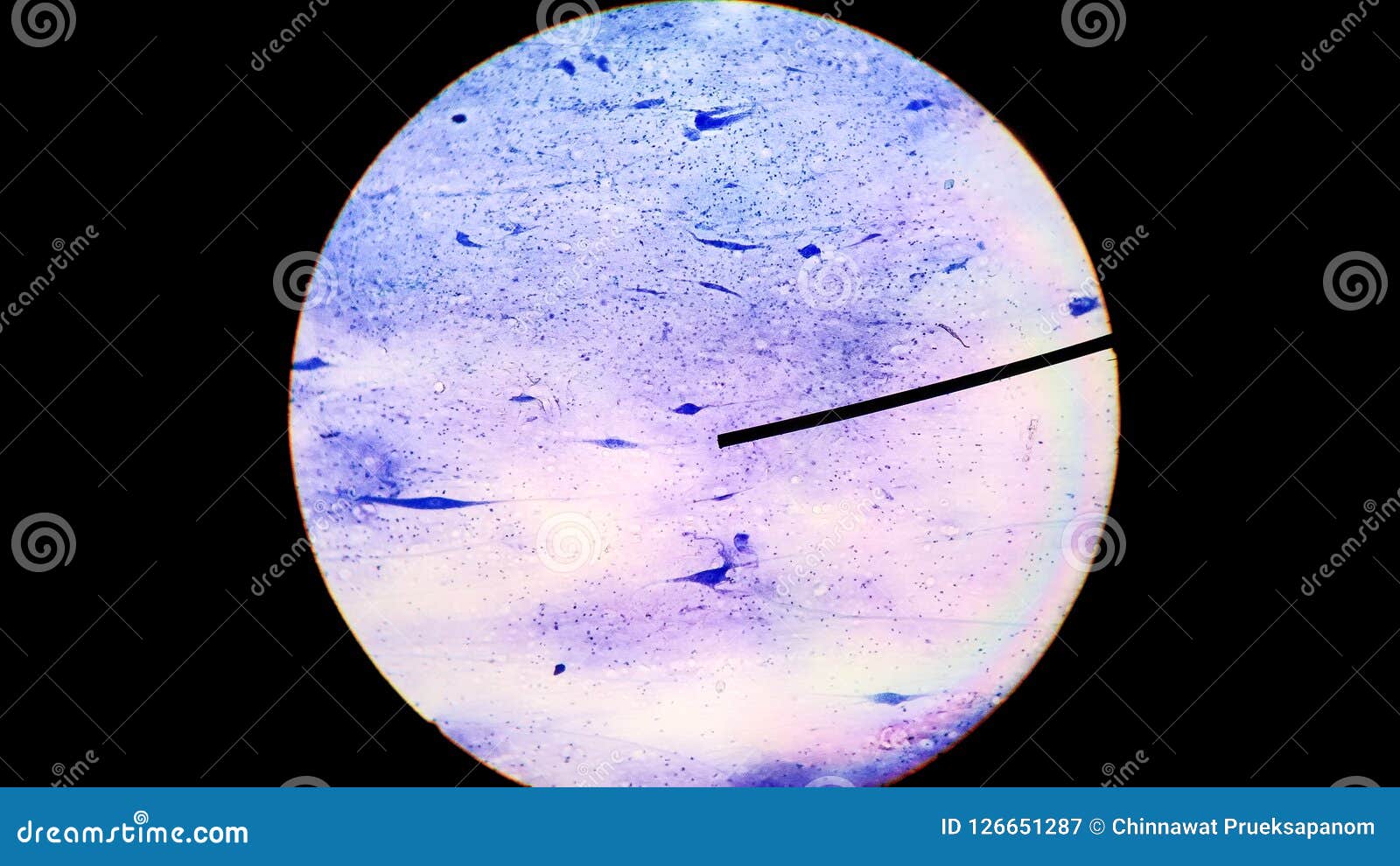 Neurons Cells from Medulla. Stock Image - Image of medical, nucleus ...