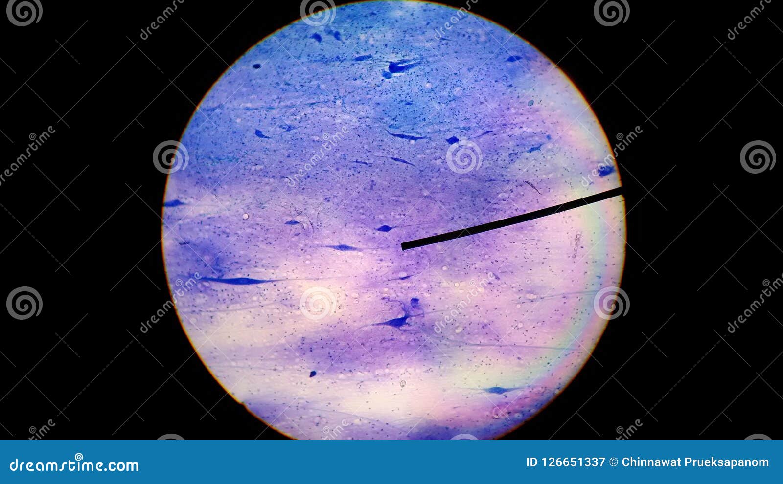 Neurons Cells from Medulla. Stock Image - Image of medical, nucleus ...