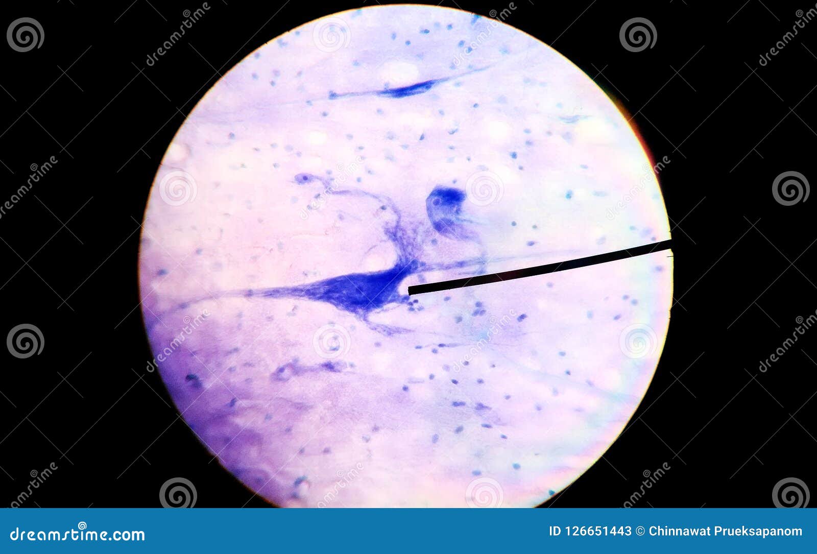 Neurons Cells From The Brain Under The Microscope View Stock ...