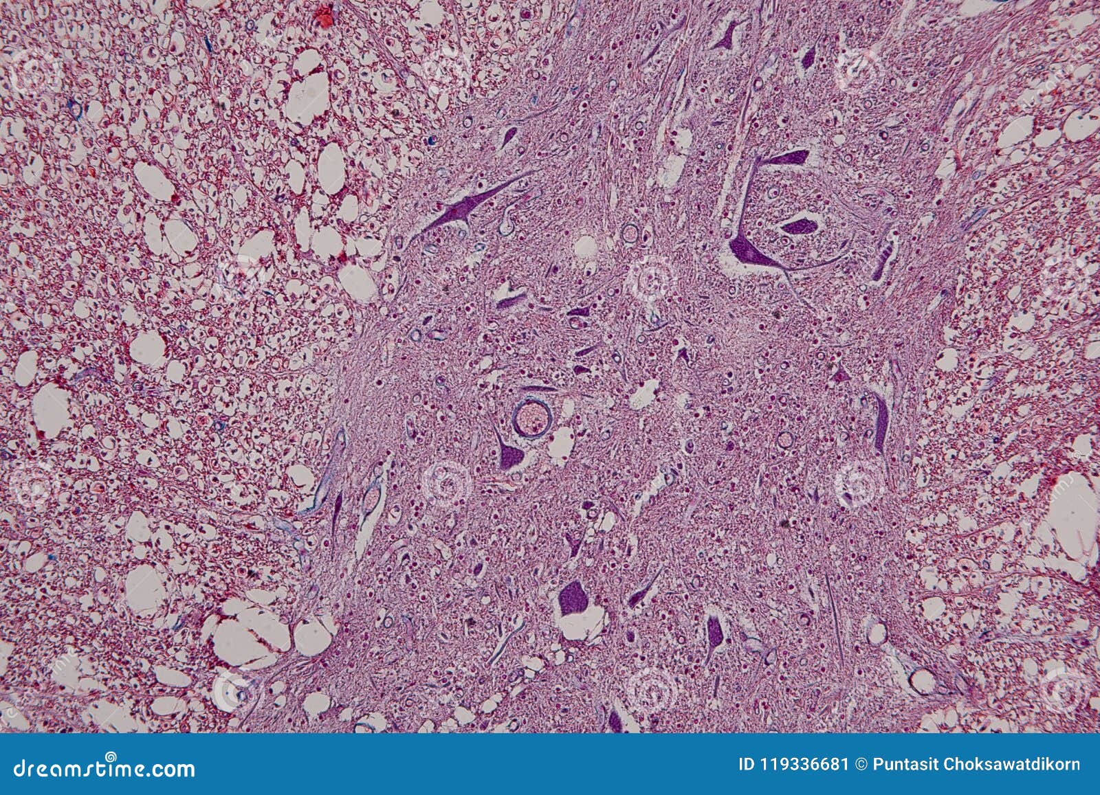 Neurons Cells from the Spinal Cord Under Microscope View Stock Image ...