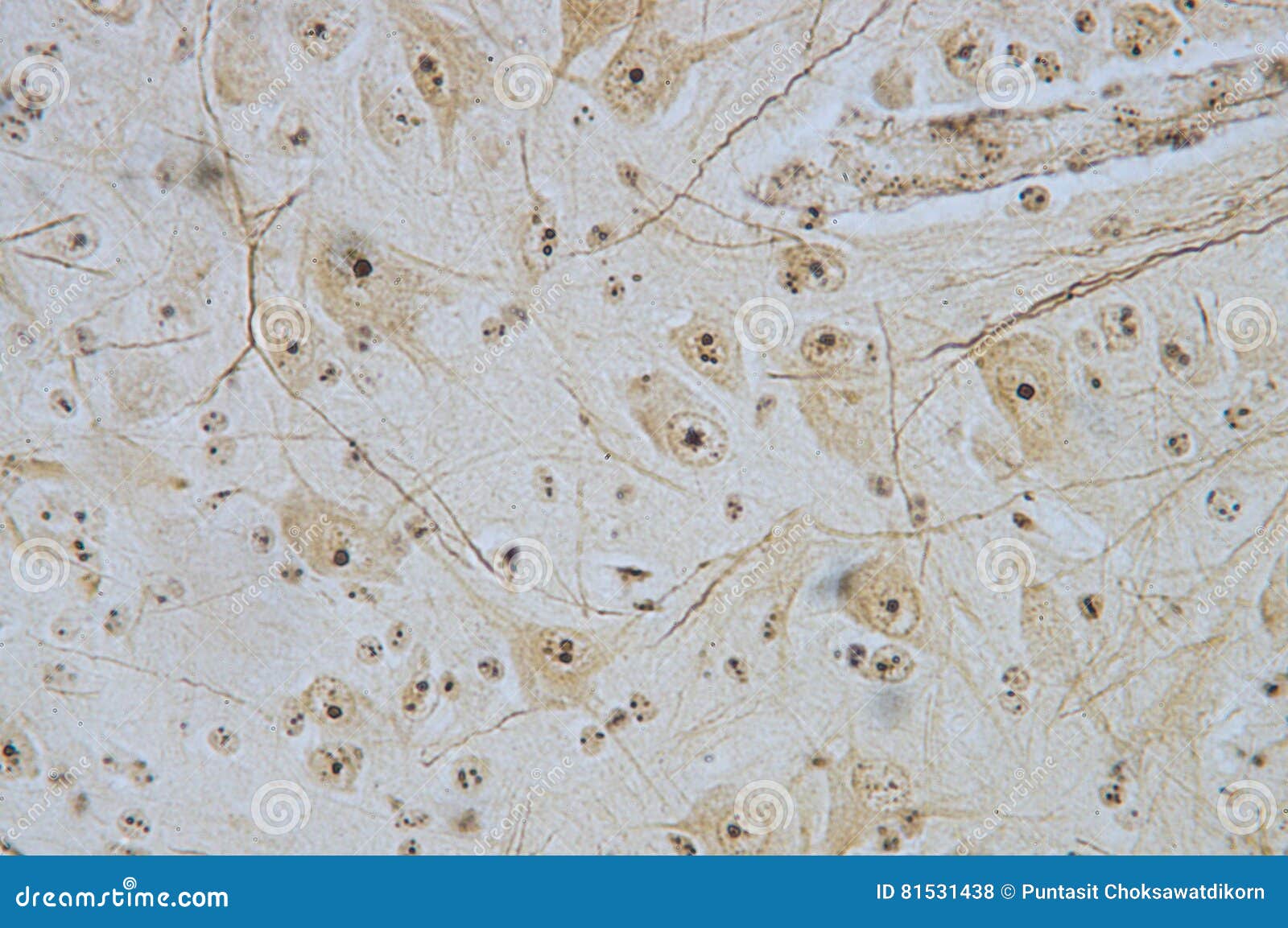 Neurons Cells From The Spinal Cord Under Microscope View. Stock Image ...