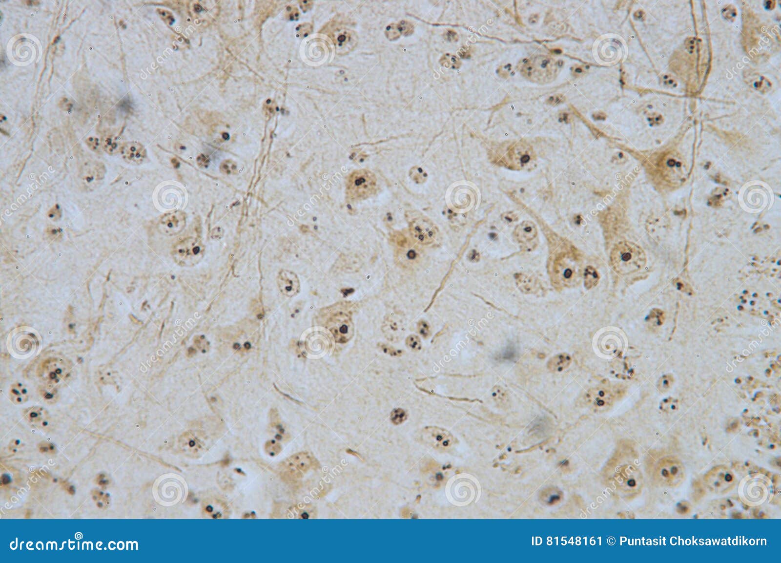Neurons Cells From The Spinal Cord Under Microscope View. Stock Image ...