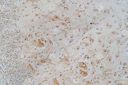 Neurons Cells from the Spinal Cord Under Microscope View. Stock Photo ...