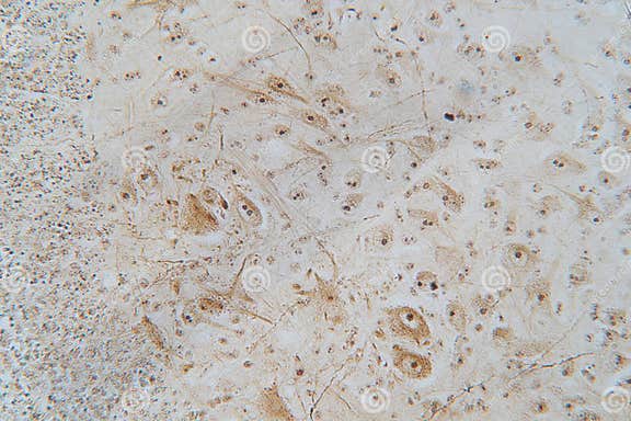 Neurons Cells from the Spinal Cord Under Microscope View. Stock Photo ...