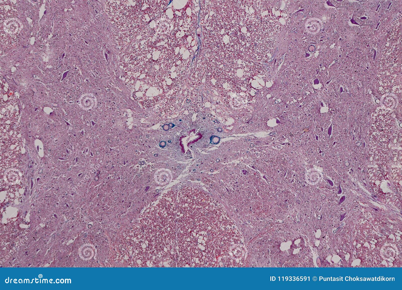 Neurons Cells from the Spinal Cord Under Microscope View Stock Image ...