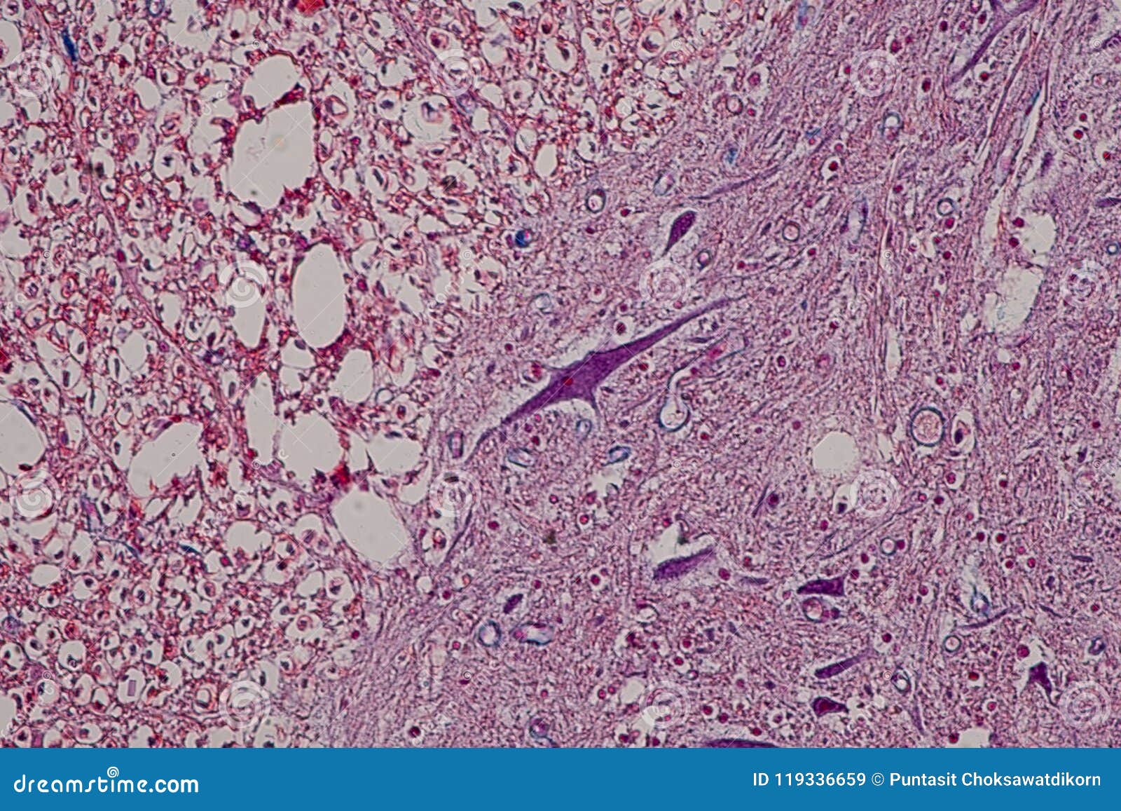 Neurons Cells from the Spinal Cord Under Microscope View Stock Image ...