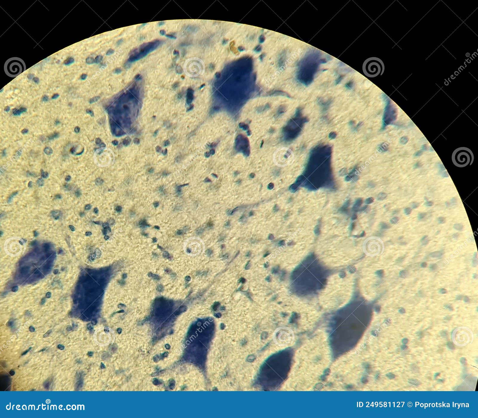 Neurocytes with Processes. Cell Structure of Nervous Tissue Stock Image ...