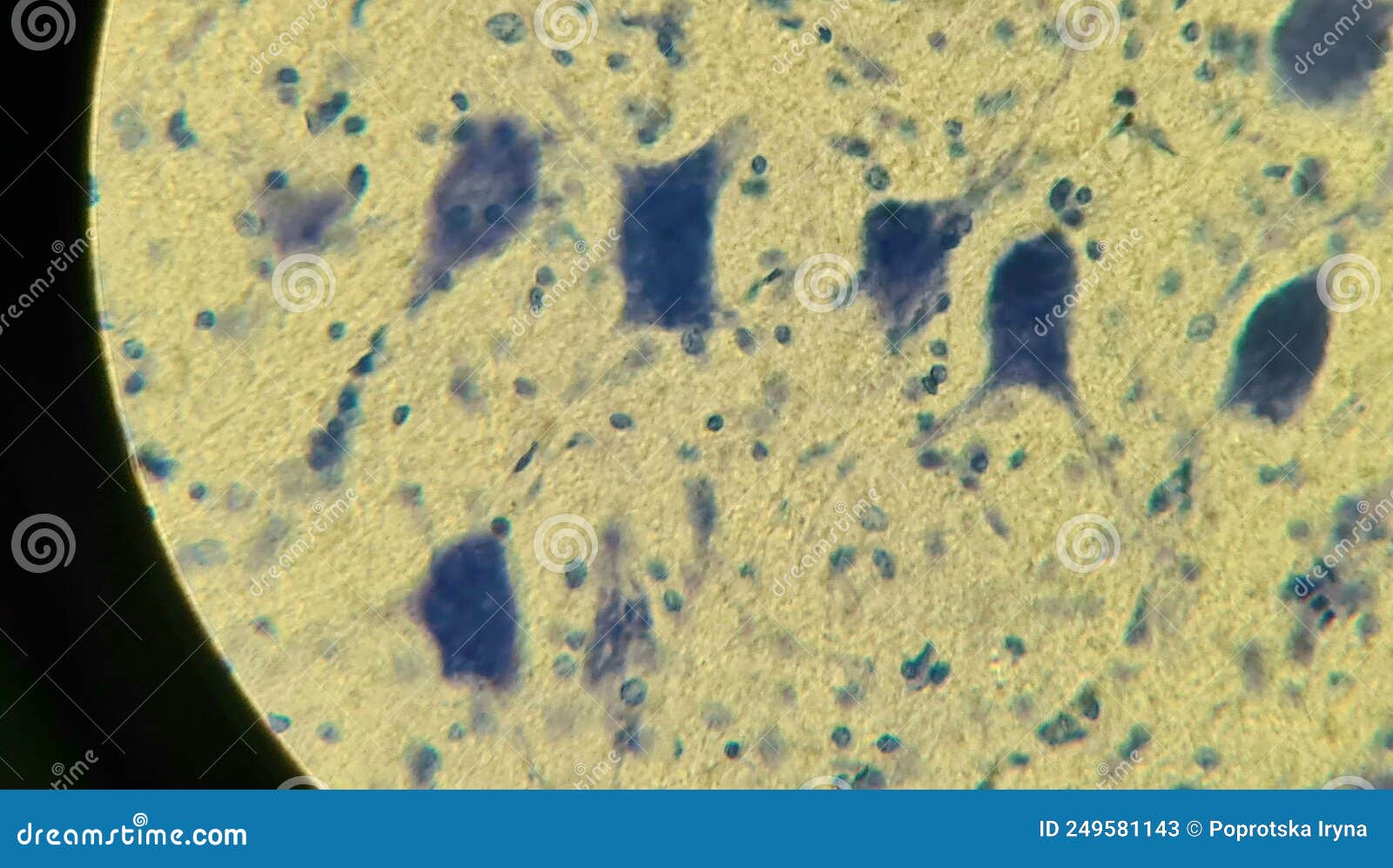 Neurocytes with Processes. Cell Structure of Nervous Tissue Stock Image ...