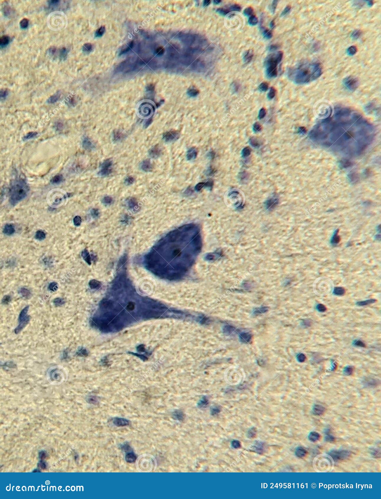 Neurocytes with Processes. Cell Structure of Nervous Tissue Stock Image ...