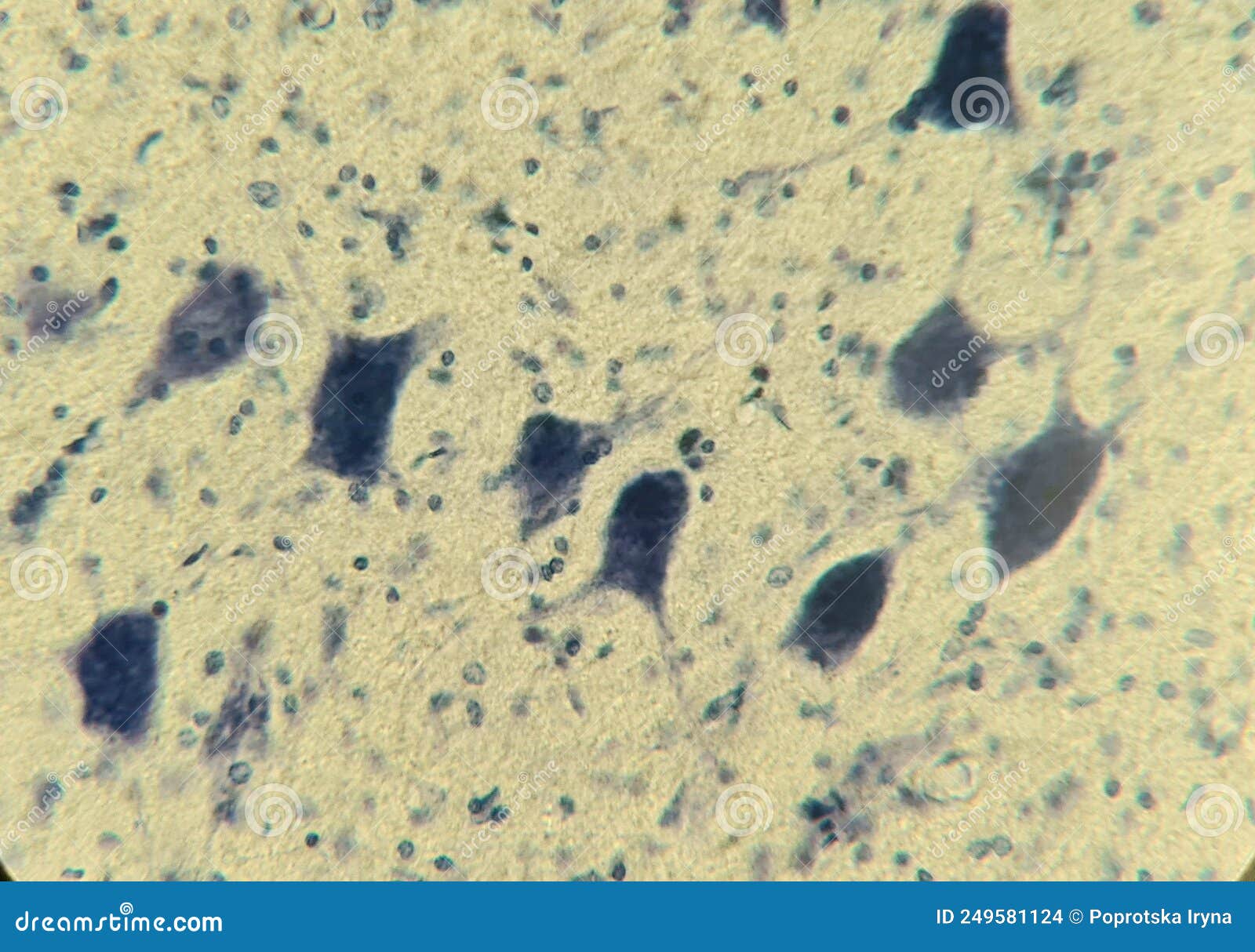 Neurocytes With Processes. Cell Structure Of Nervous Tissue Stock Image ...