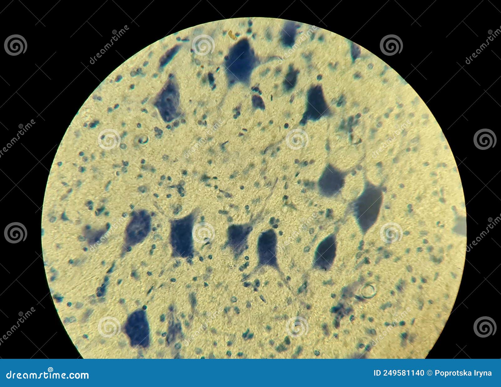 Neurocytes With Processes. Cell Structure Of Nervous Tissue Royalty ...