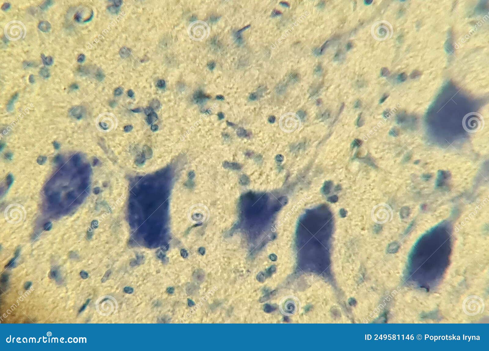 Nervous Tissue Under A Microscope Royalty-Free Stock Photography ...