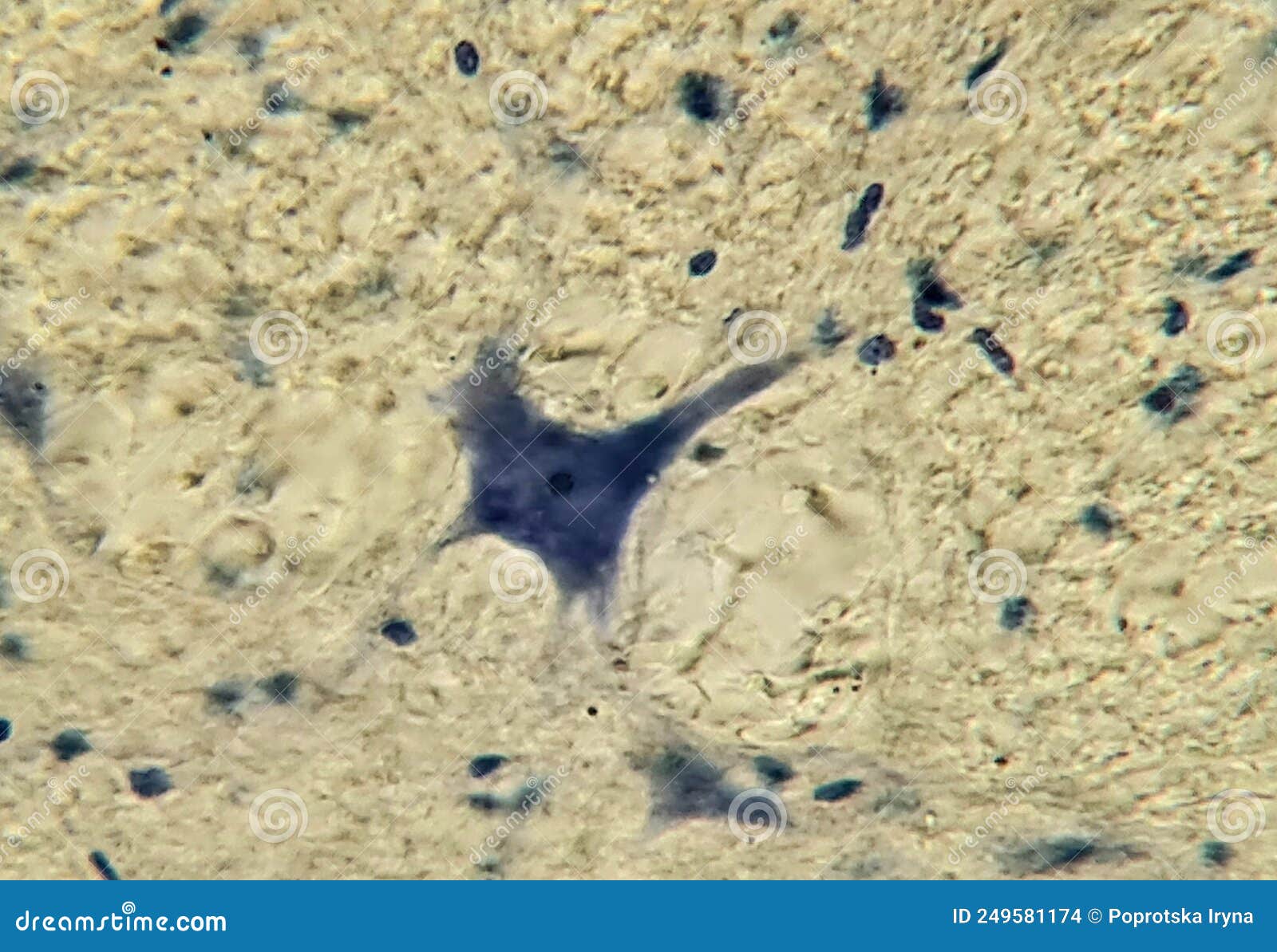 Neurocytes With Processes. Cell Structure Of Nervous Tissue Stock ...