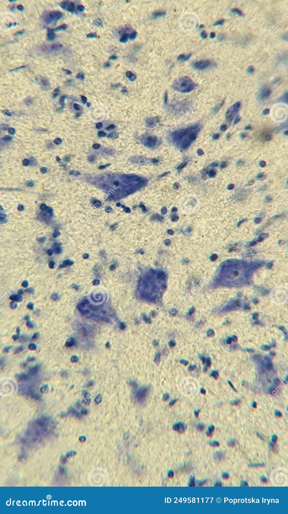 Neurocytes With Processes. Cell Structure Of Nervous Tissue Royalty ...