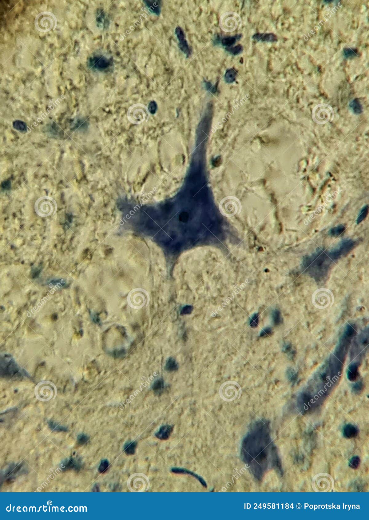 Nervous Tissue Under A Microscope Royalty-Free Stock Photography ...