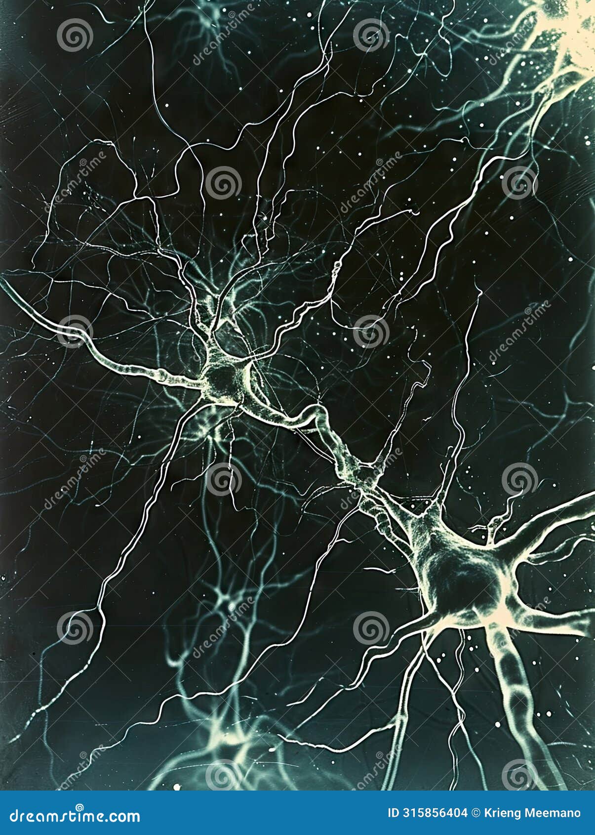 Impulses Traveling Between Neurons Through Axons On Purple Background ...