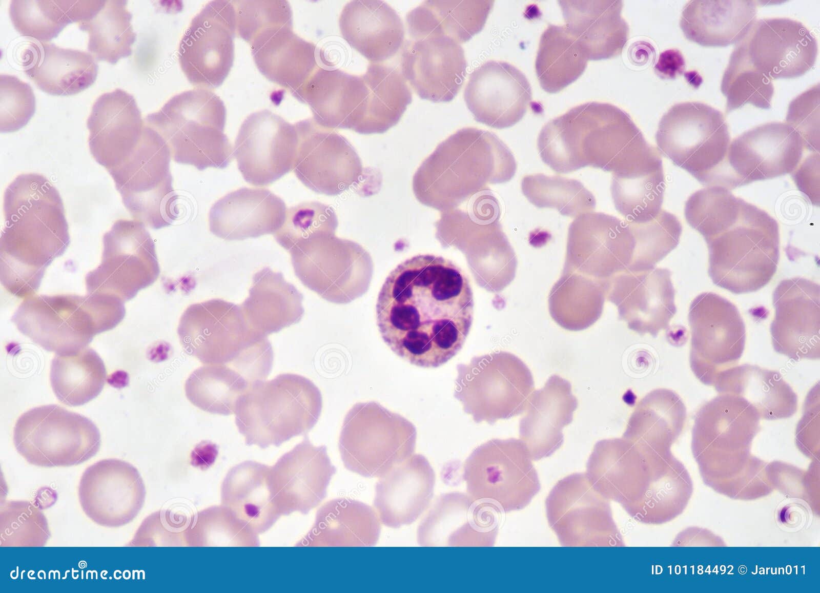 Neutrophil cell stock photo. Image of laboratory, platelet - 101184492
