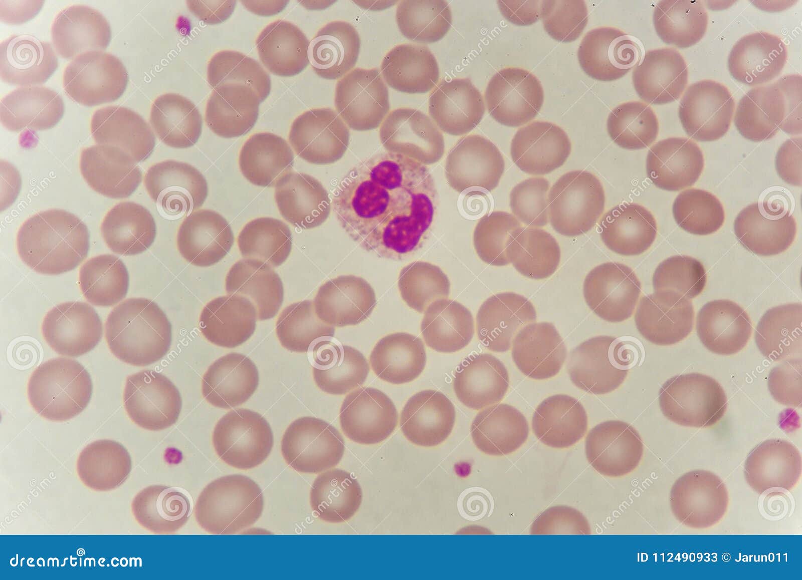 Neutrophil Cell in Blood Smear Stock Image - Image of cell, analyzing ...