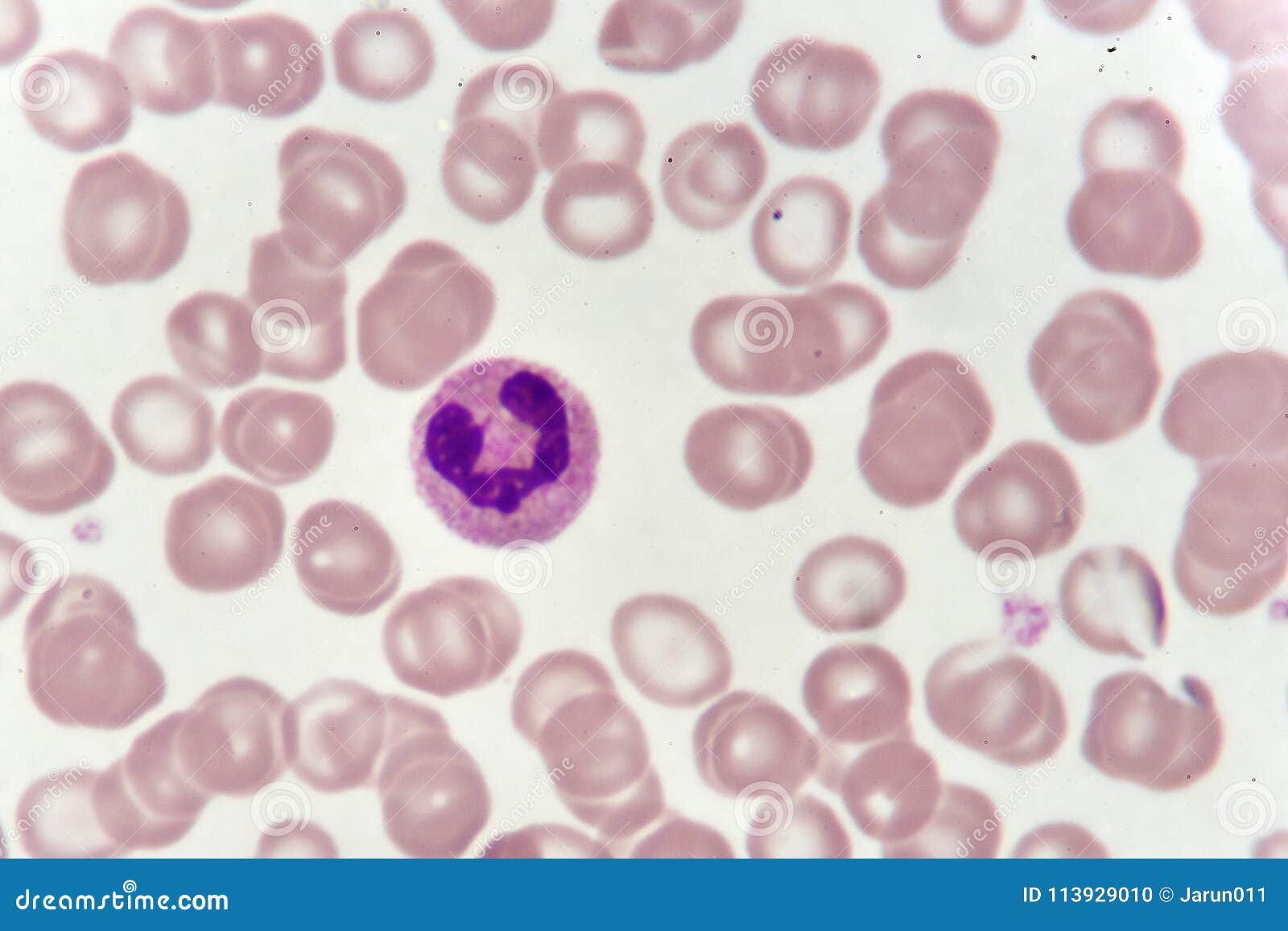 Neutrophil Cell White Blood Cell In Blood Smear Stock Photography ...