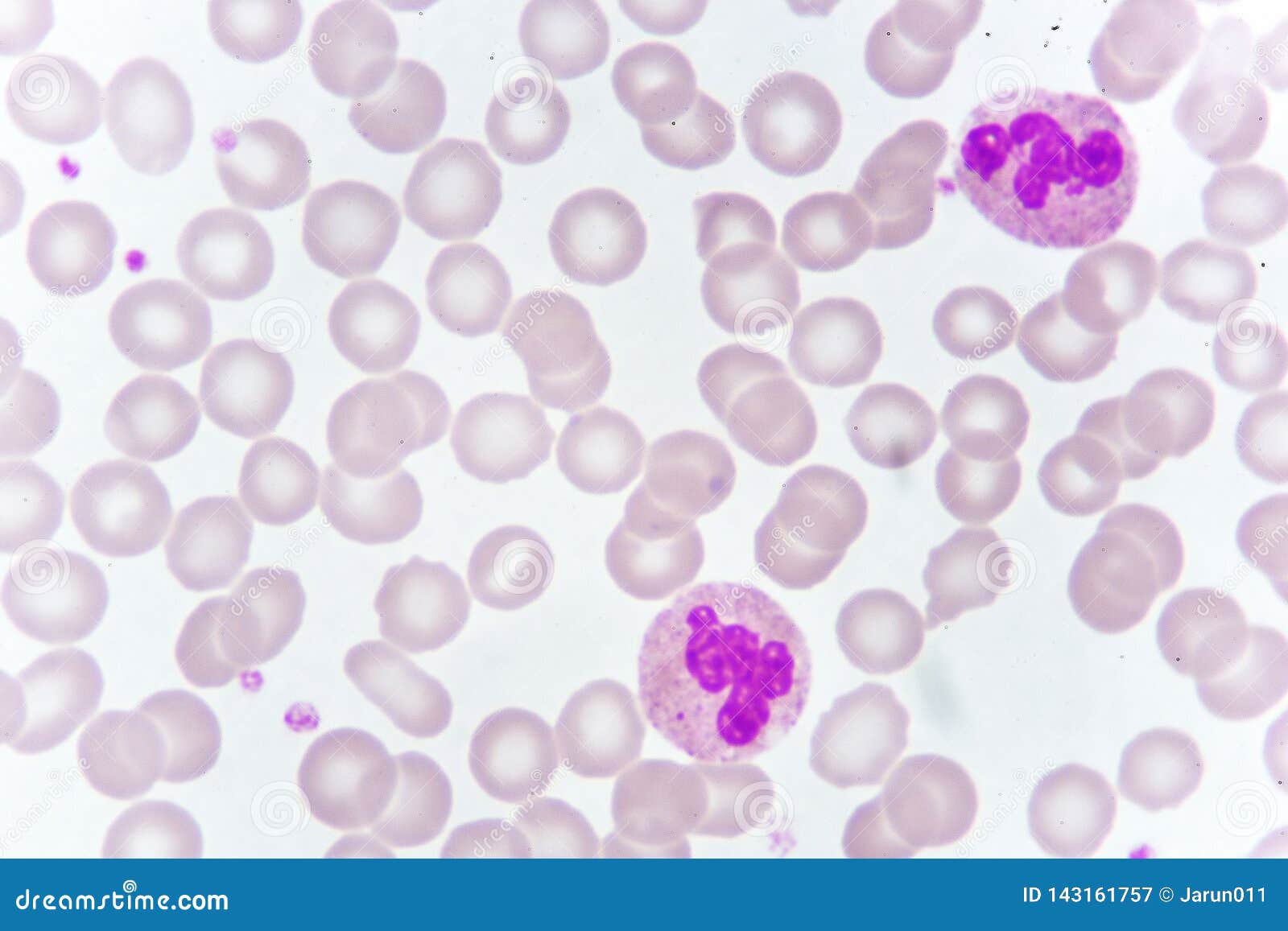 Neutrophil Cell in Blood Smear Stock Image - Image of hemophilia, film ...