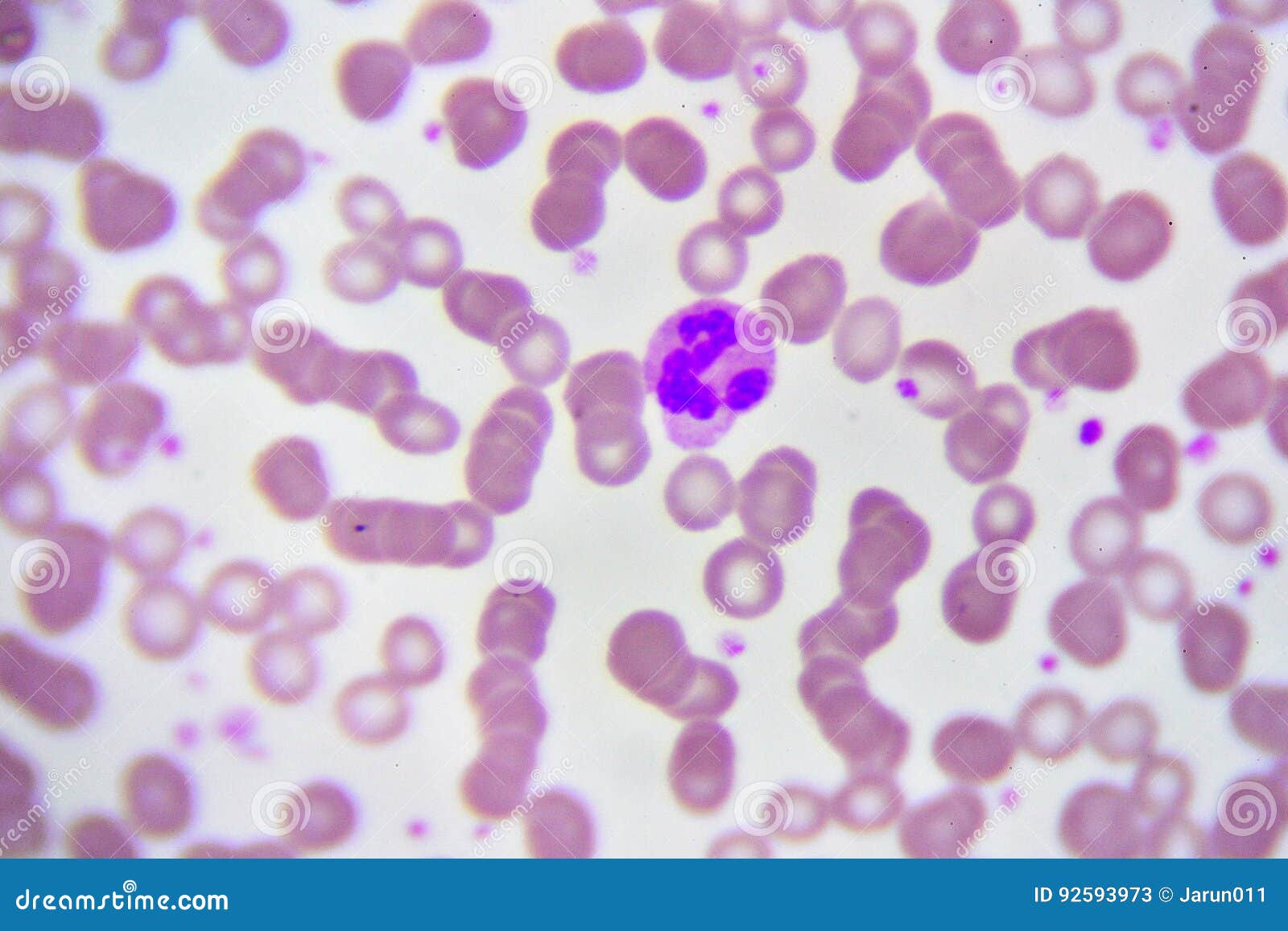 Neutrophil cell stock image. Image of analyze, leukemia - 92593973
