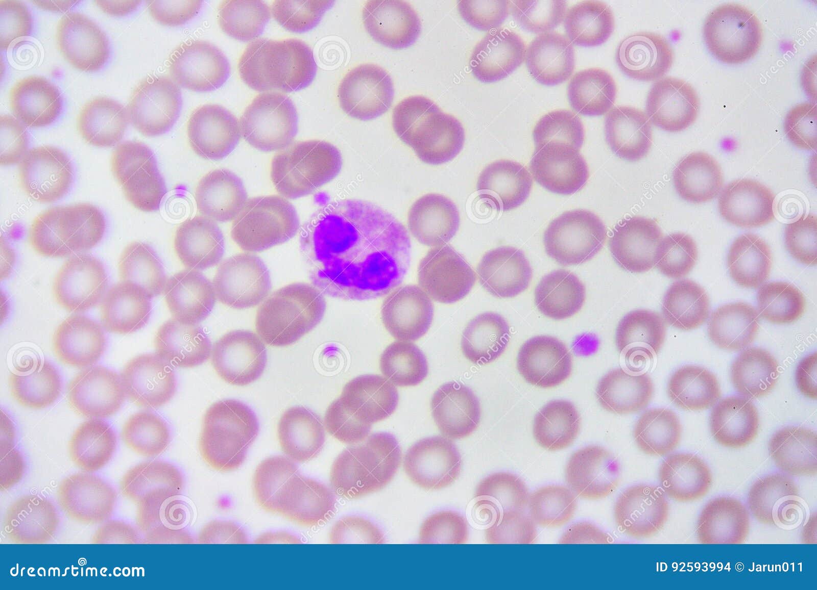 Neutrophil Cell White Blood Cell In Blood Smear Stock Photography ...