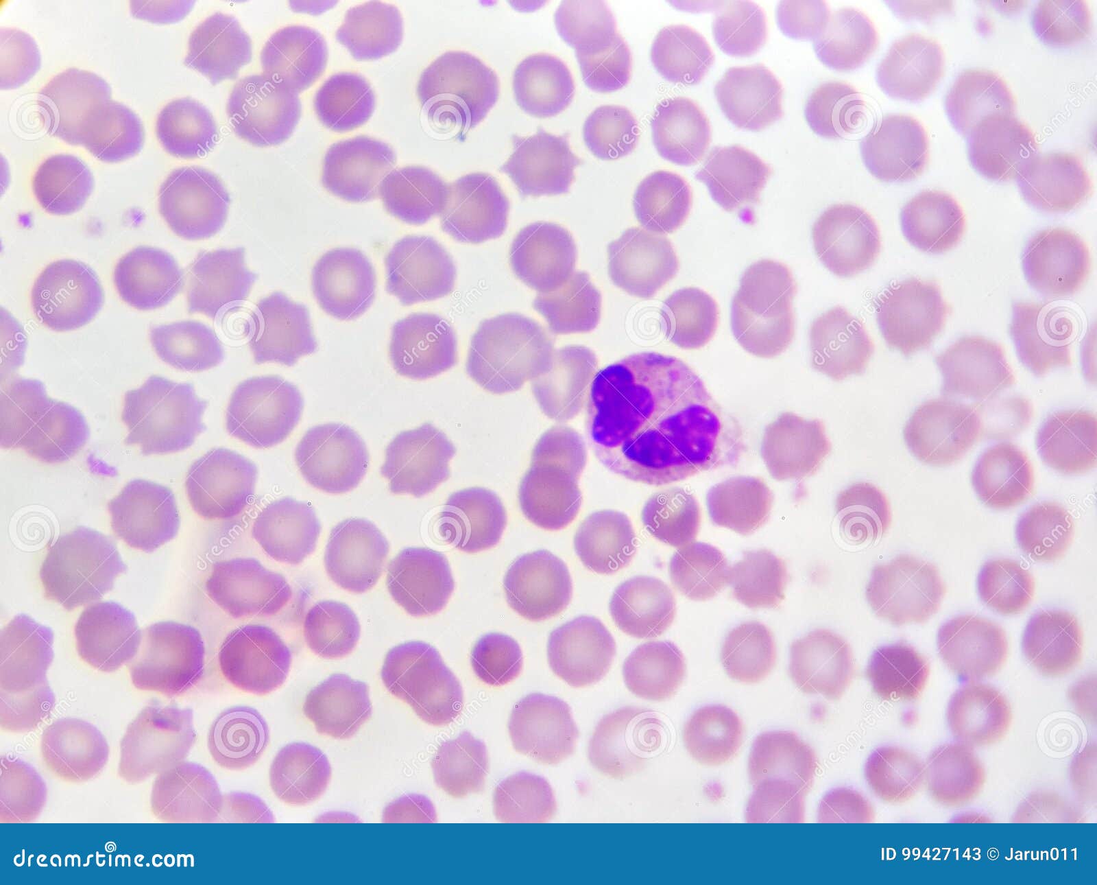 Neutrophil cell stock image. Image of examination, monocyte - 99427143