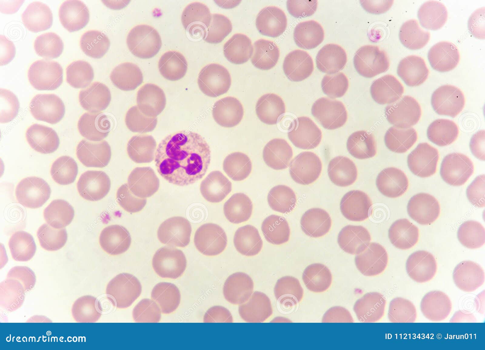 Neutrophil Cell in Blood Smear Stock Photo - Image of eosinophil ...