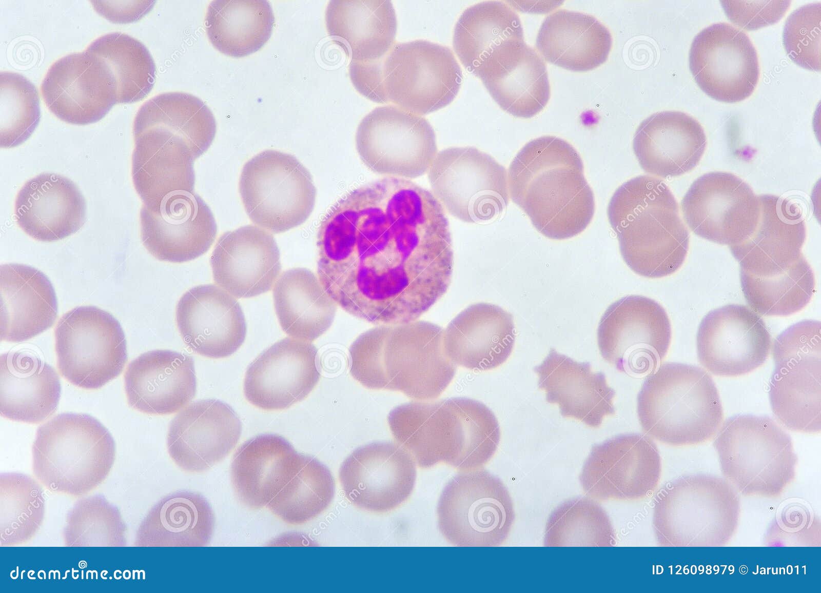 Neutrophil Cell in Blood Smear Stock Image - Image of microscopy ...