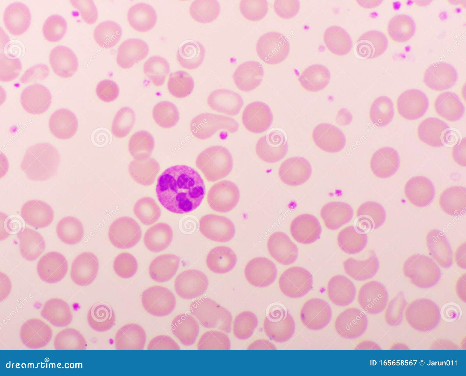 Neutrophil Cell in Blood Smear Stock Image - Image of erythrocyte ...