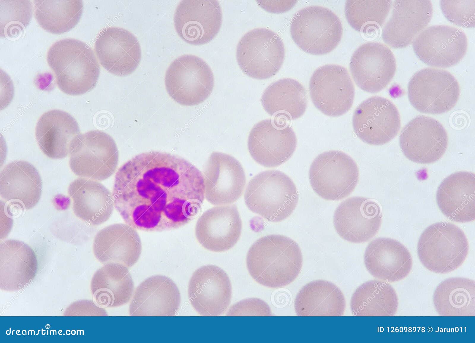 Neutrophil Cell in Blood Smear Stock Photo - Image of laboratory ...