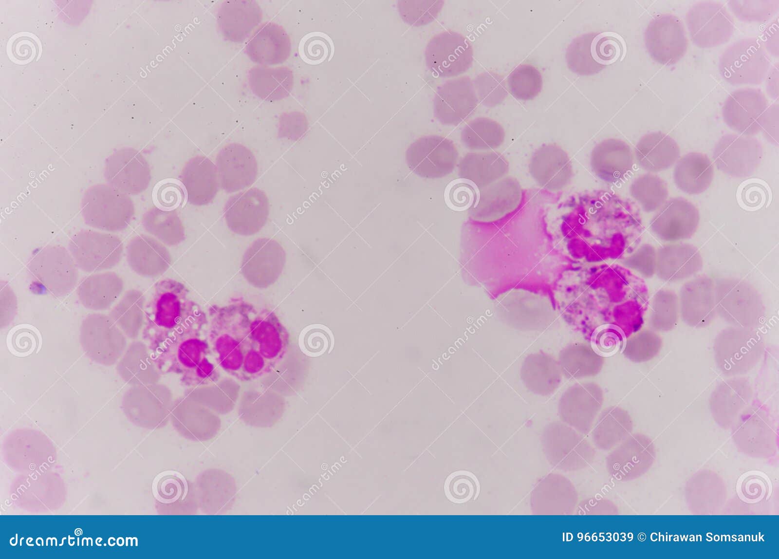 Neutrophil Cell in Blood Smear Stock Image - Image of disease ...