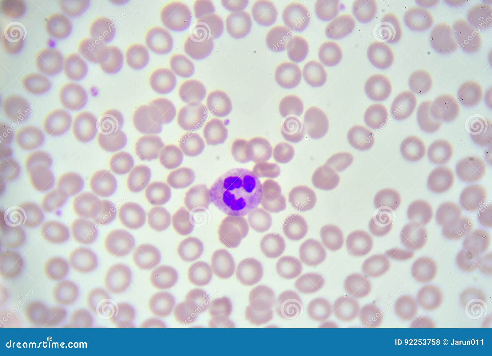 Monocyte And Neutrophil Cell In Blood Smear Royalty-Free Stock Image ...