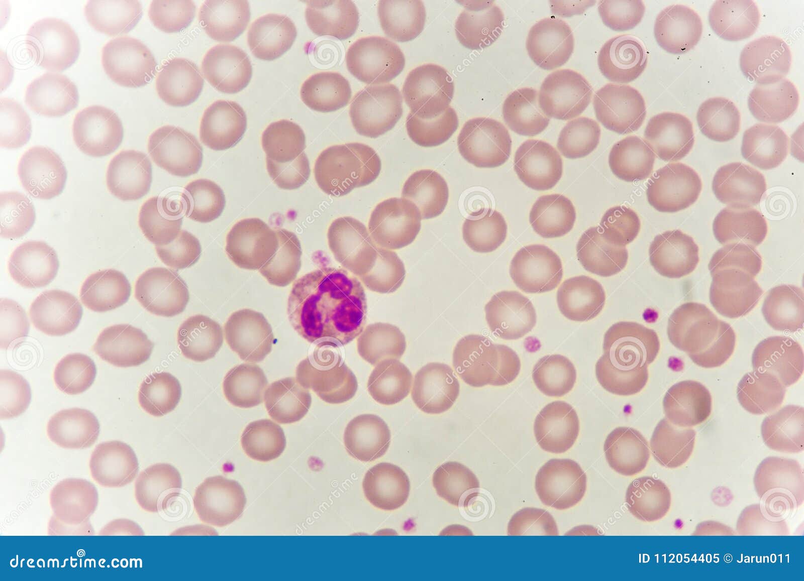 Neutrophil White Blood Cells On Red Blood Cells Background Stock ...