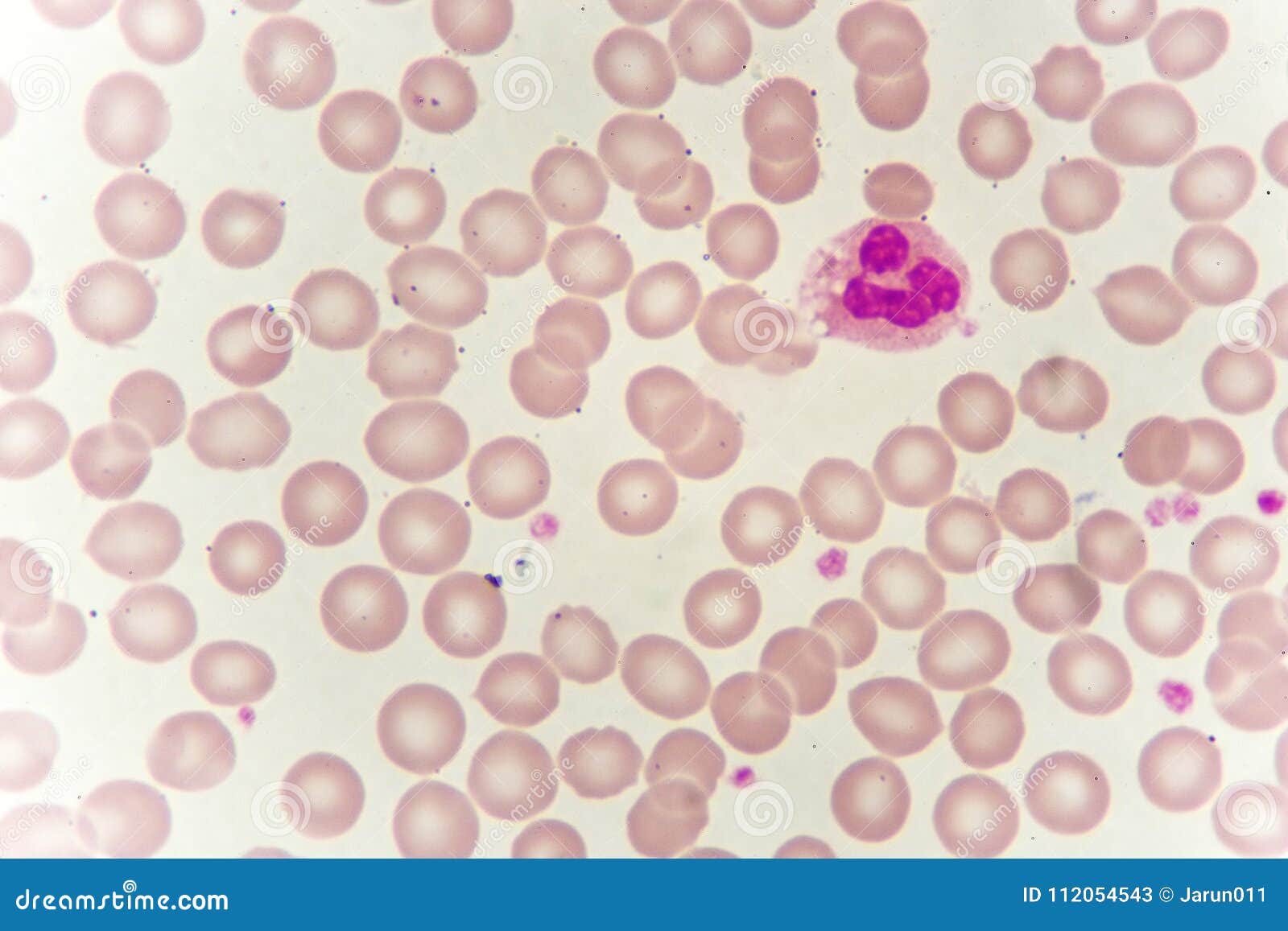 Neutrophil cell stock image. Image of anemia, research - 112054543