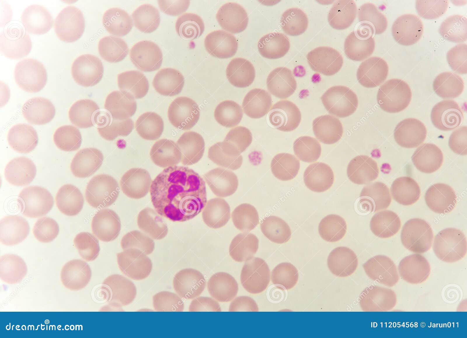 Neutrophil Cell White Blood Cell In Blood Smear Stock Photography ...
