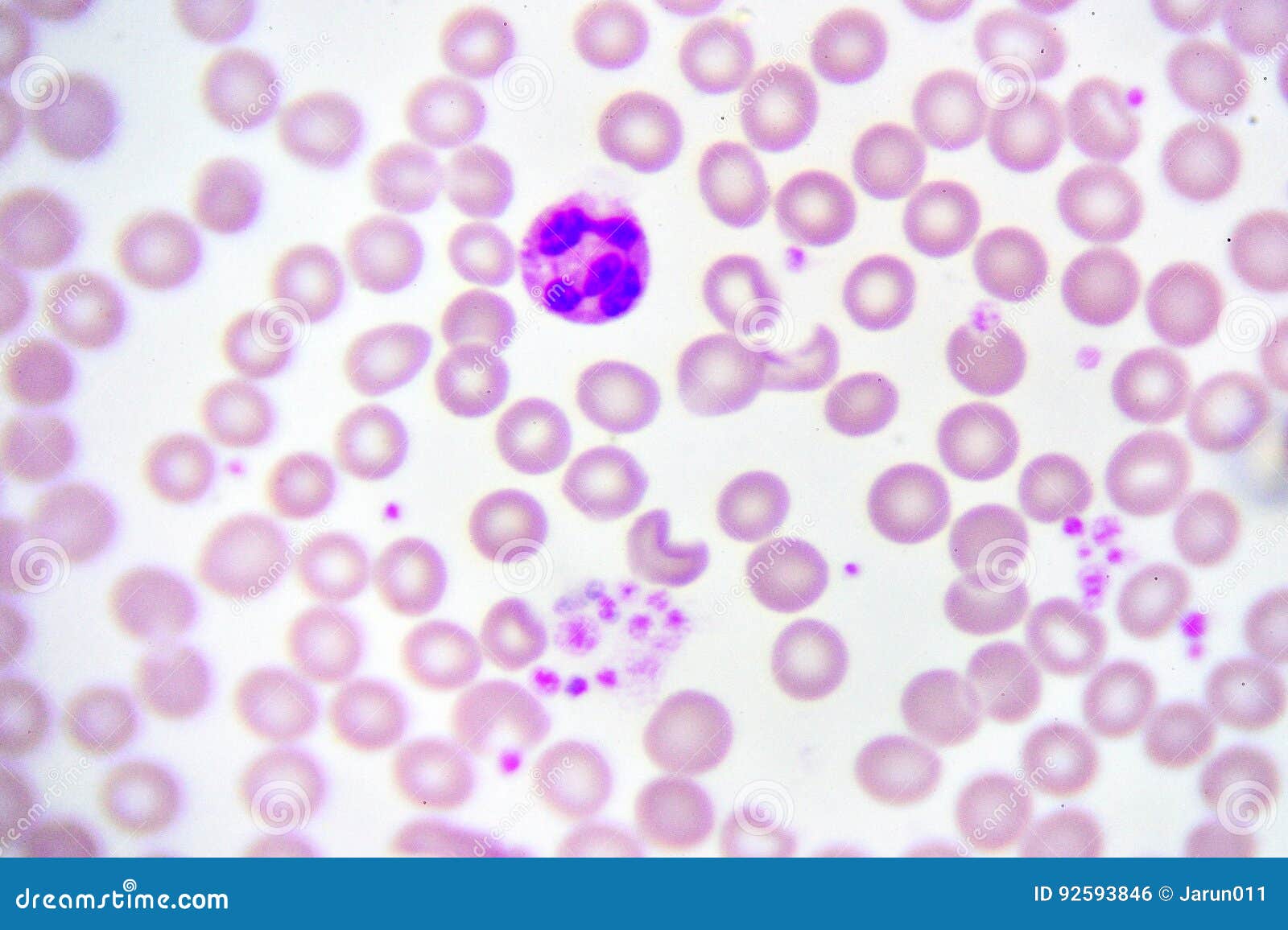 Neutrophil Cells Stock Photography | CartoonDealer.com #92593898