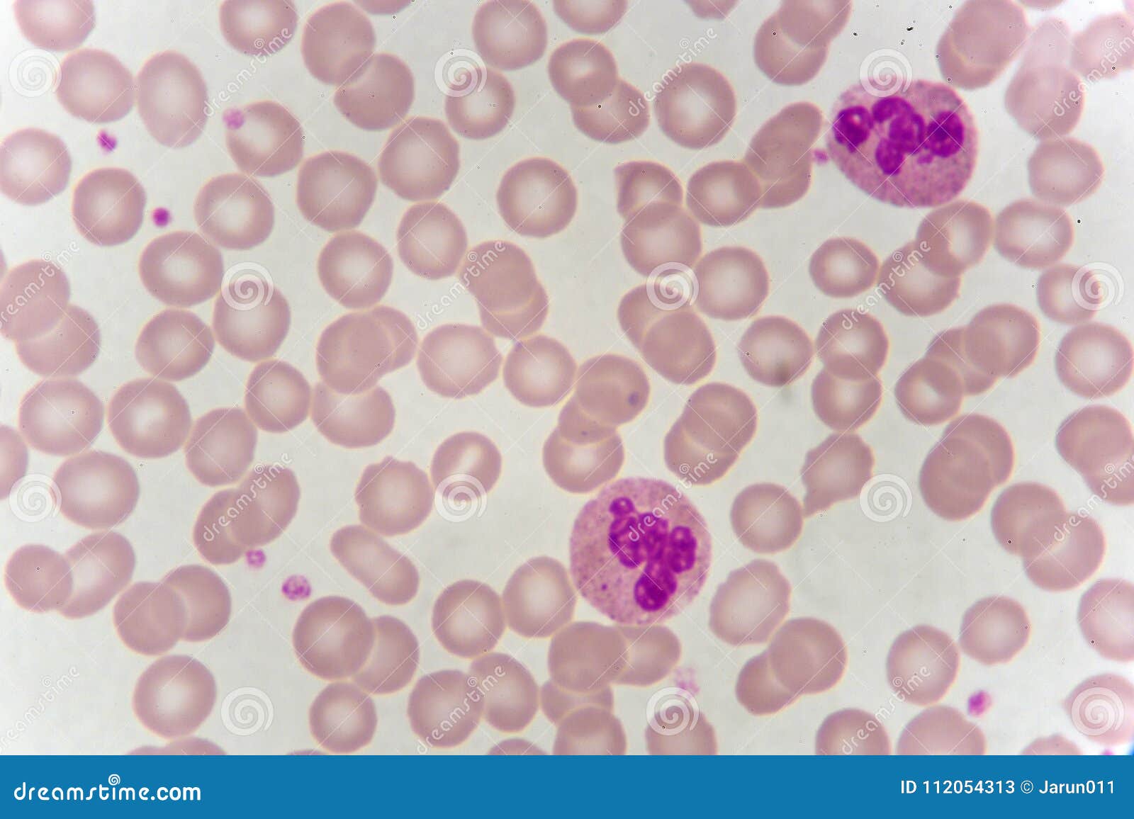 Neutrophil cells stock image. Image of hematology, analyzing - 112054313