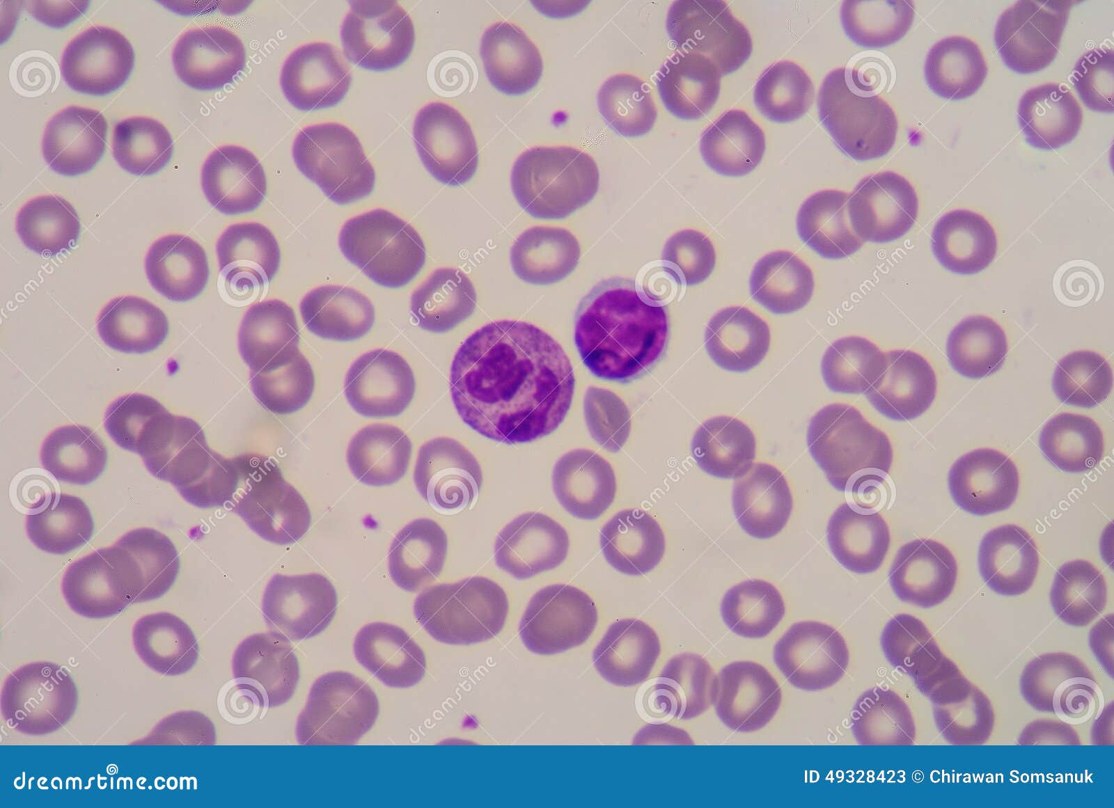 Neutrophil en lymfocyt stock afbeelding. Image of antigeen - 49328423