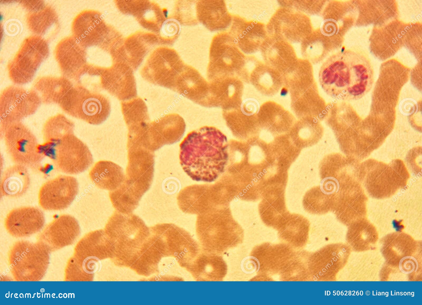 Neutrophil and Eosinophilic Granulocyte Stock Photo - Image of cell ...